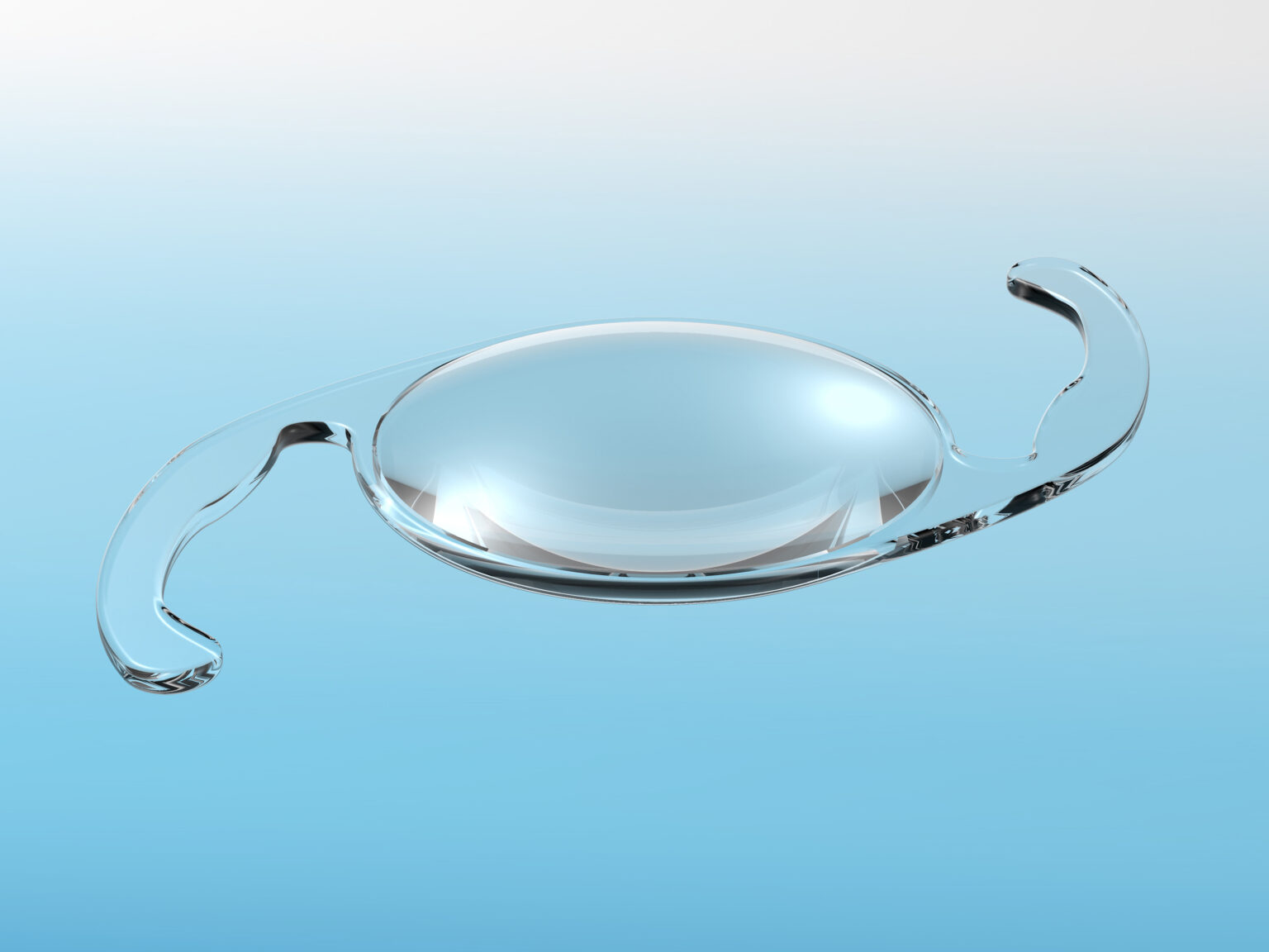 Understanding How Long Cataract Surgery Takes in the UK - RightClinic.com